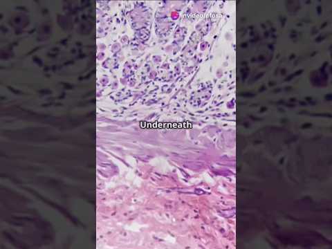 Anatomy of the Dermis in Under 60 Seconds! | Nurse Edition #generaldermatology