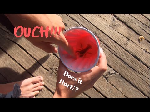 Does a Crayfish Pinch Hurt!?