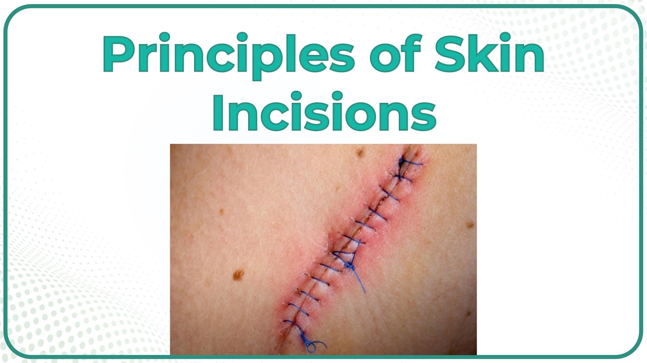 Explain principles of Skin incisions: National exit test / Based on CBME Anatomy Curriculum