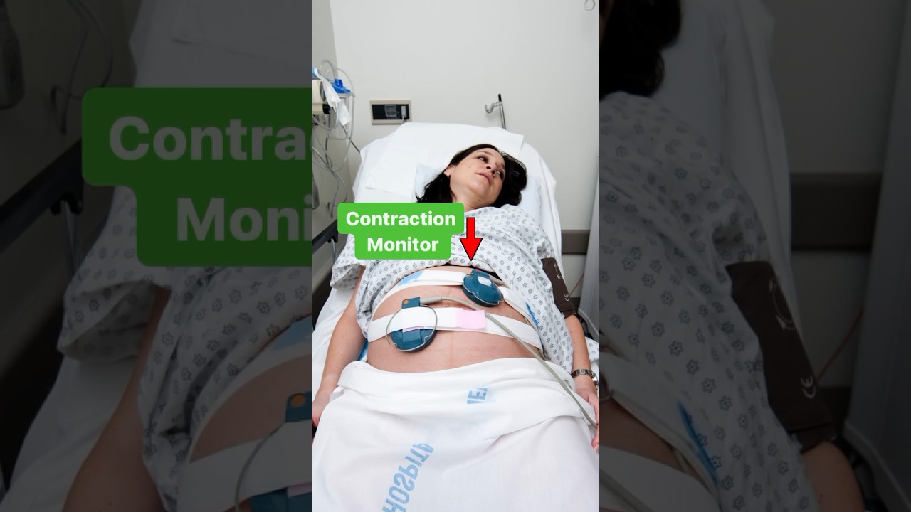 How You Are Monitored in Labor #birth #laboranddelivery