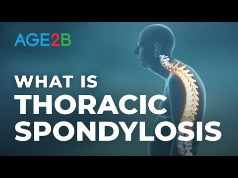 What Is Thoracic Spondylosis? | Spondylolysis & Spondylolisthesis | Definition