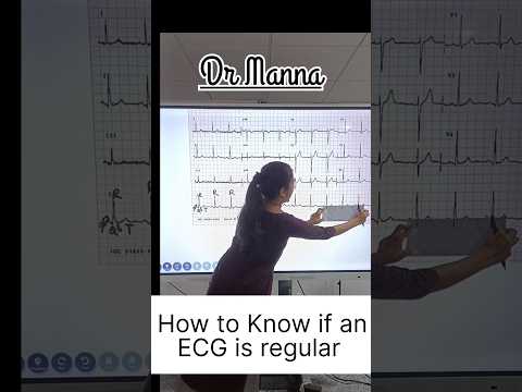 Do You Have a Minute || How to know ECG is regular or not #aetcm #doctor #emrapid