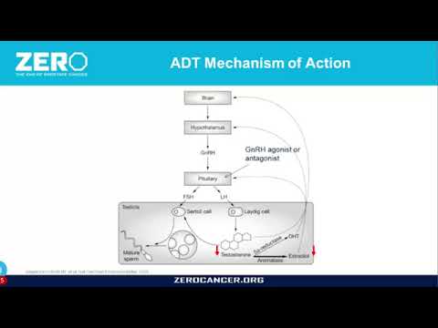 Webinar: What You Need to Know About ADT