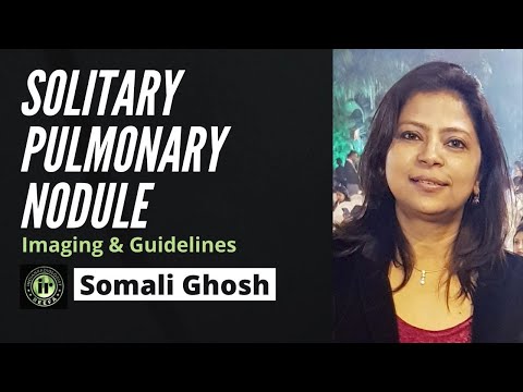 SOLITARY PULMONARY NODULE | DR SOMALI GHOSH | CT CHEST | SUBSOLID NODULES | ADENOCARCINOMA