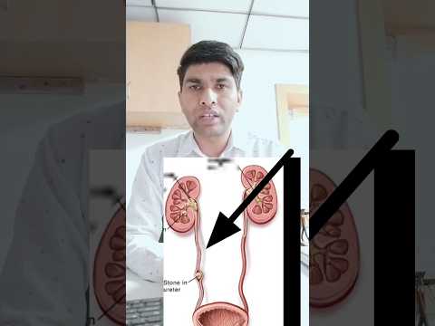 What is Hydronephrosis, Causes of Hydronephrosis #kidneydisease #hydronephrosis