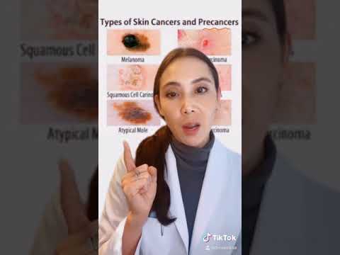 Types of skin cancers, Part 2: precancers & atypical moles | Dr. Mamina