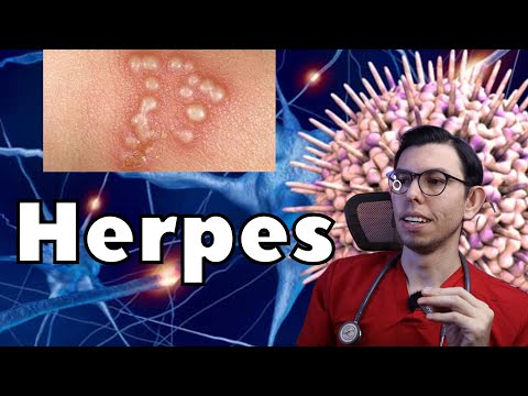 ¡TODO lo que debes conocer sobre HERPES! | Drpologuerrero