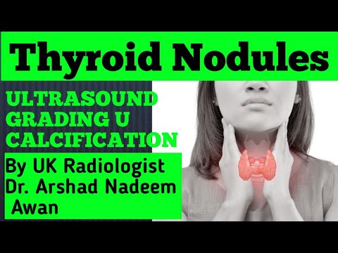 Thyroid Nodules Classification Benign, Indeterminate and Malignant Nodules in Urdu Hindi