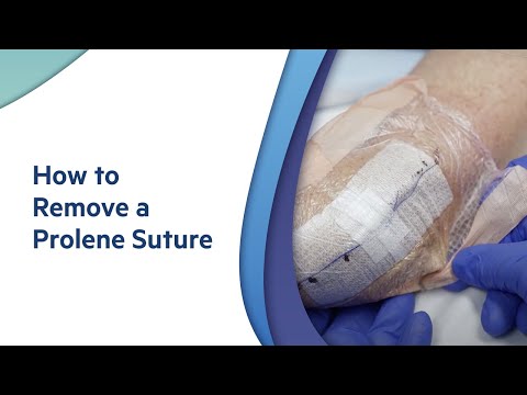 How To: Remove a Prolene Suture. By an Orthopaedic Surgeon.