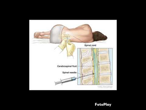 MYELOGRAPHY DIAGRAM-1