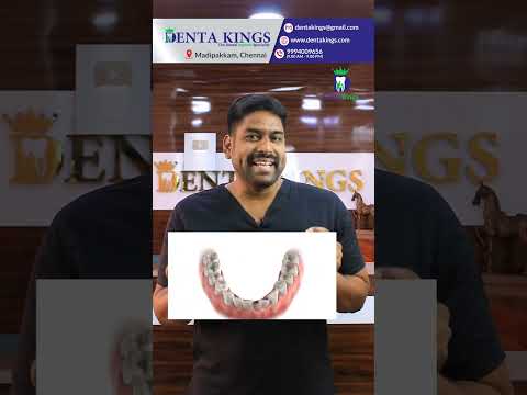 கிளிப் போட பல் எடுத்தால் அந்த இடைவெளி என்ன ஆகும்?-Space Closure After Ortho Extraction | Denta Kings