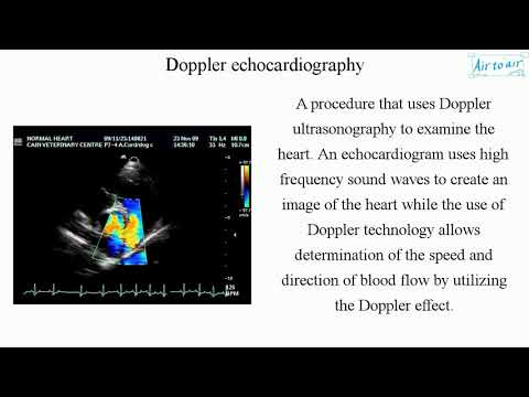 Doppler echocardiography (English) - Medical terminology for medical students -