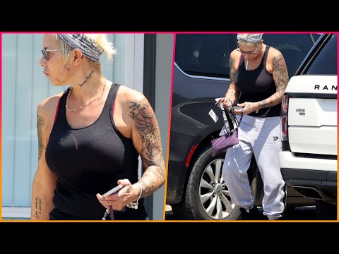 Kim Mathers is seen with a facial injury while running errands after her ex Eminem gave a nod to