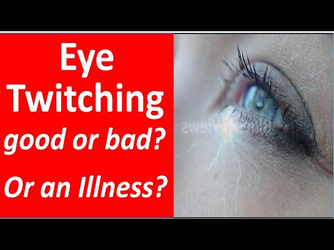 Eye twitching/ Blinking myths vs facts, excessive Blinking is a indicator of mental problems.