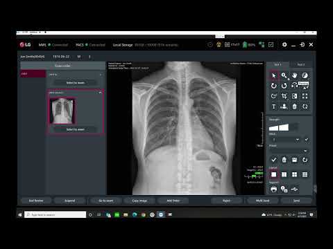 GE X Ray Machine - Latest Price, Dealers & Retailers in India