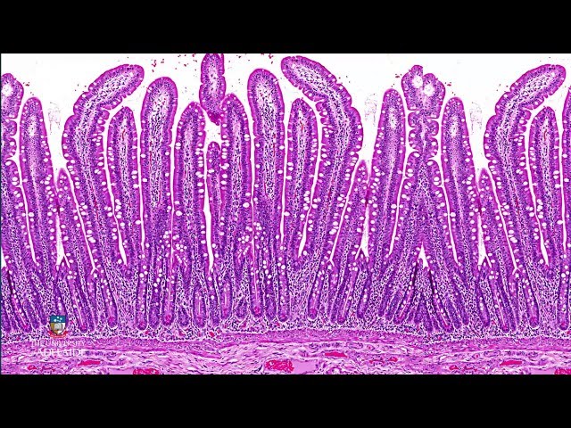 Understanding Tissue Processing For Light Microscopy A Step By Step 4702
