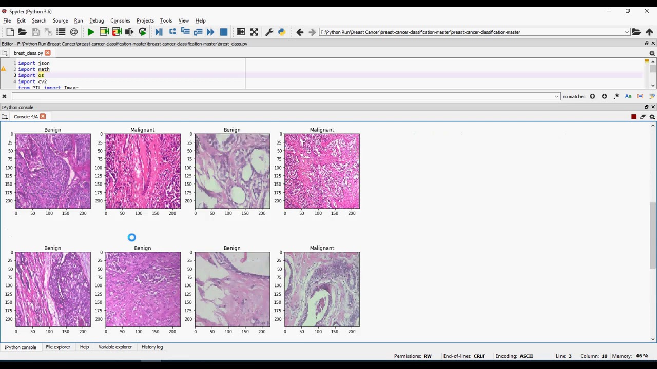 Breast Cancer Classification Using Python - OKOK PROJECTS- Final Year ...