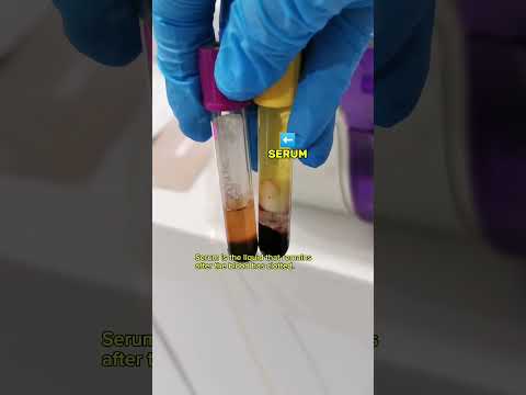 Plasma vs Serum #laboratory #medtechstudent #cls #mls