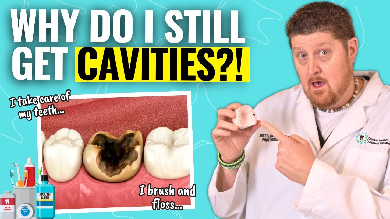 Why You’re Getting Cavities Even with Perfect Dental Care