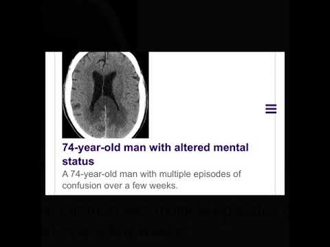 Gliomatosis cerebri