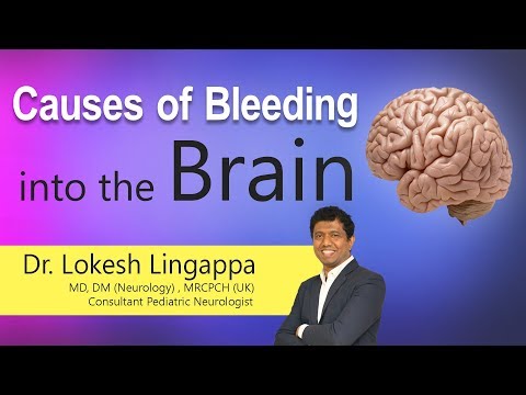 Hi9 | Causes of Bleeding into the Brain | Dr.Lokesh Lingappa | Pediatric Neurologist