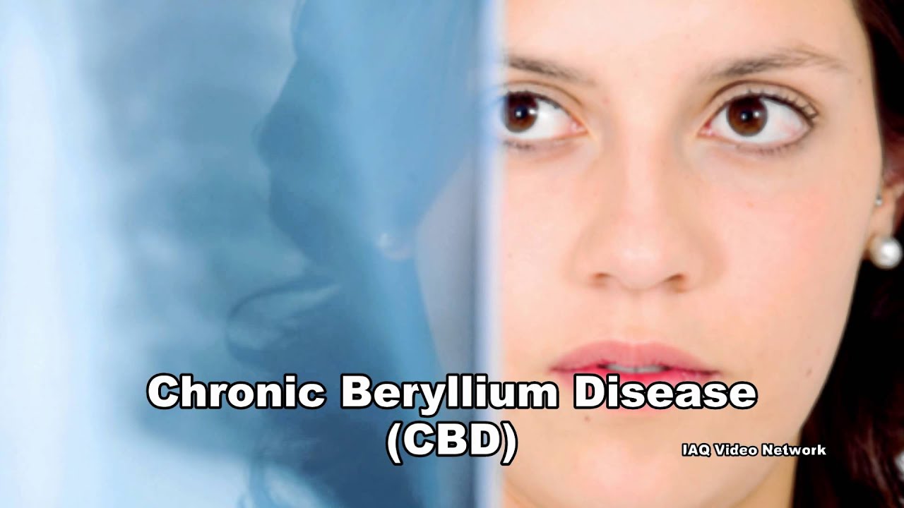 Beryllium & Chronic Beryllium Disease (CBD)