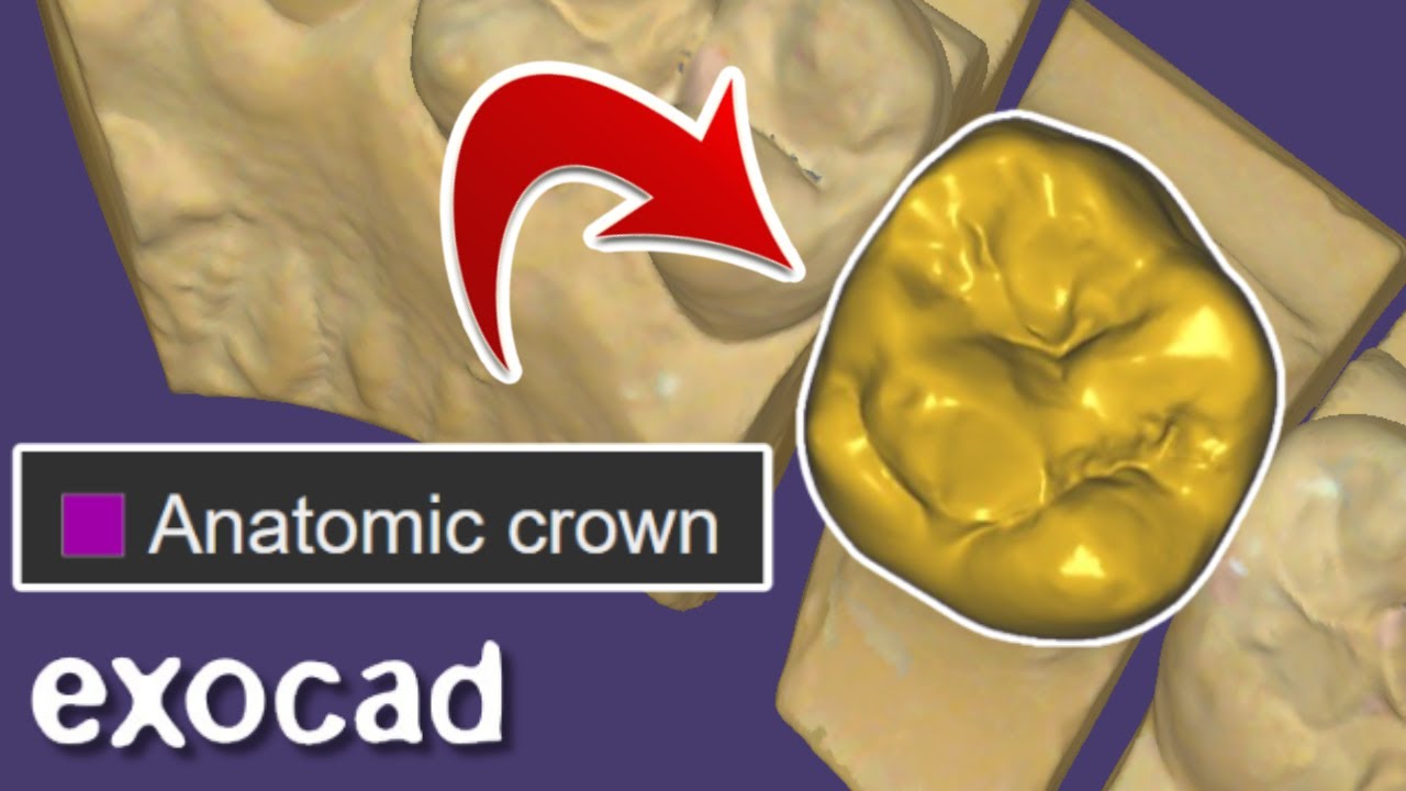 CROWN Design EXOCAD. 2024 Tutorial