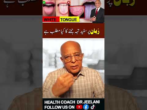 What does a white coating on the tongue mean?زبان پر سفید تہہ جمنے کا کیا مطلب ہے ||By Drjeelani