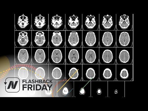 Flashback Friday: Preventing Brain Loss with B Vitamins? – Robert Finch