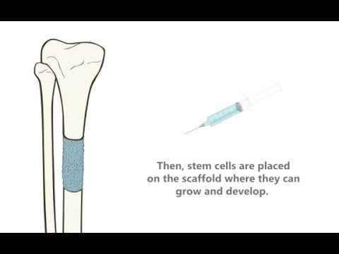 Bone Scaffolding