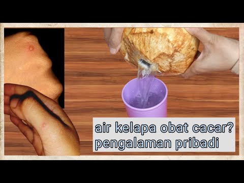 AIR KELAPA MUDA UNTUK CACAR AIR? saya bagi pengalamam sendiri sembuh dlm 4 hari #cacarair #obatcacar