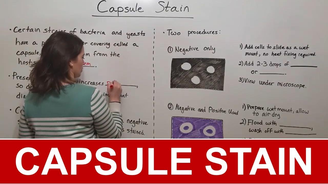 Capsule Stain