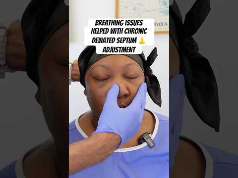 Chronic Deviated Septum Adjustment @drrahim #chiropractic #shorts