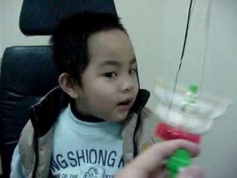Oculomotor Apraxia (OMA)