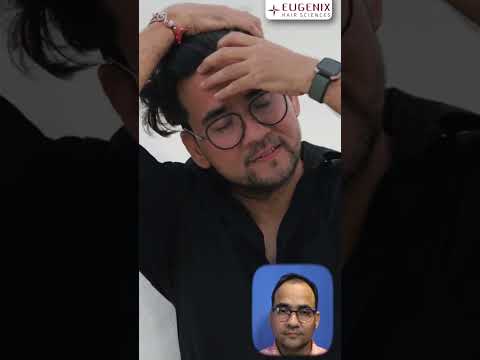 Eugenix Hair Transplant Review: Trusted Clinic with Impressive Before and After Results