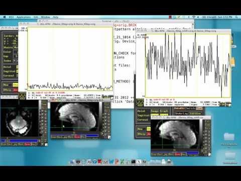 AFNI: Slice Timing Correction