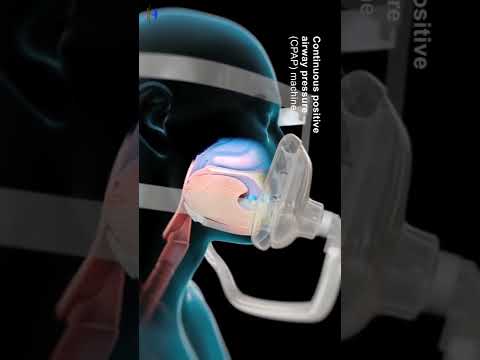 CPAP machine ( Continuous positive airway pressure ) Sleep apnea treatment /