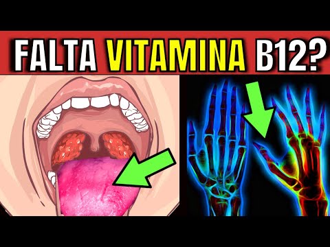 THESE are the ALARM SYMPTOMS of LACK of VITAMIN B12 in your body. How to increase vitamin b12?