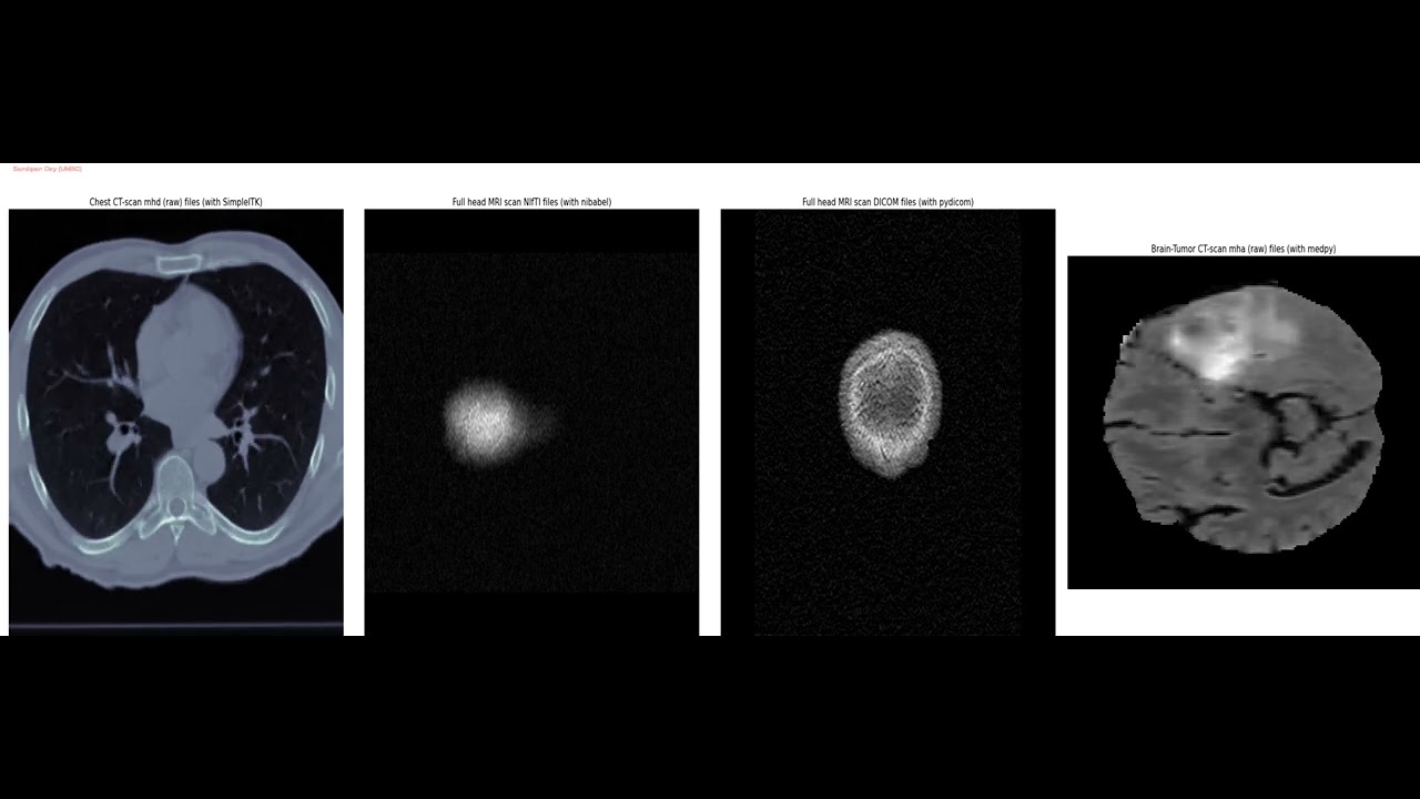 Medical Imaging | Reading/Visualizing MRI CT |  python