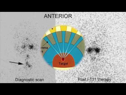 Common Radioactive Materials in Medicine