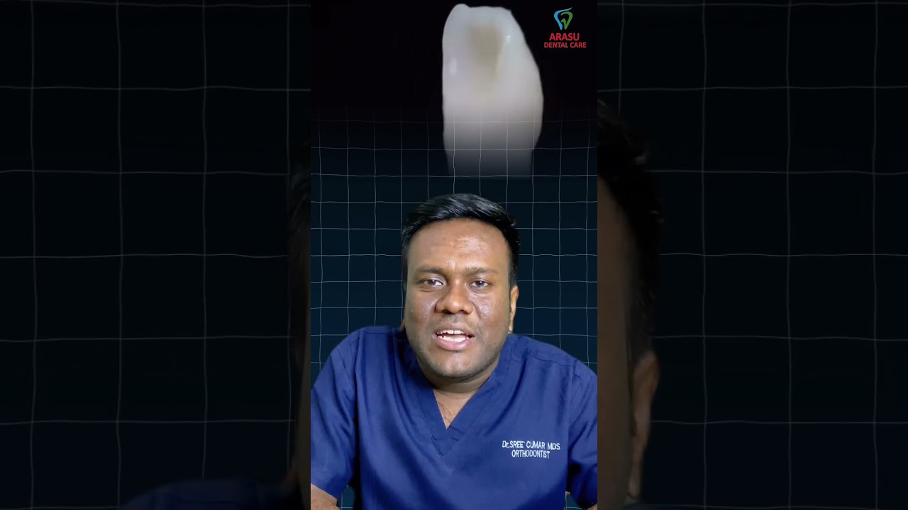 IMMEDIATE SOLUTION FOR FRONT TEETH GAP #anteriorfilling #frontteethgapfilling #teethgaptreatmment