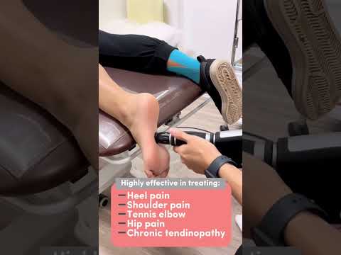 This treatment will shock you #physioandsole #podiatry #podiatrysg #fyp #shorts