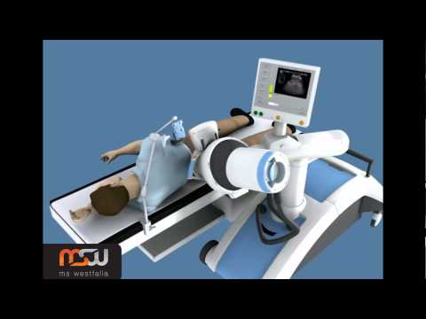 Lithotripter - Lithoclast Latest Price, Manufacturers & Suppliers