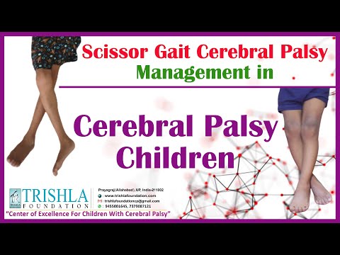 Scissor gait cerebral palsy management in cerebral palsy children ...