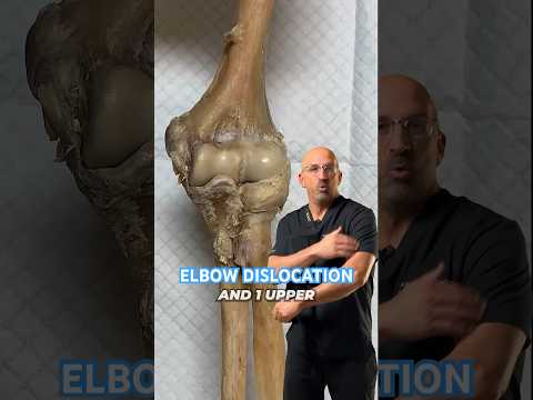 2nd Most Common Large Joint Dislocation: Is it the most painful? #shorts