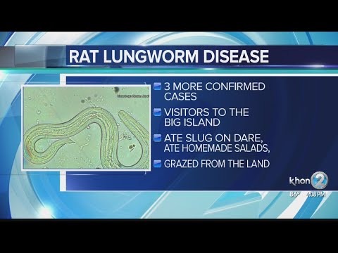 3 unrelated rat lungworm disease confirmed