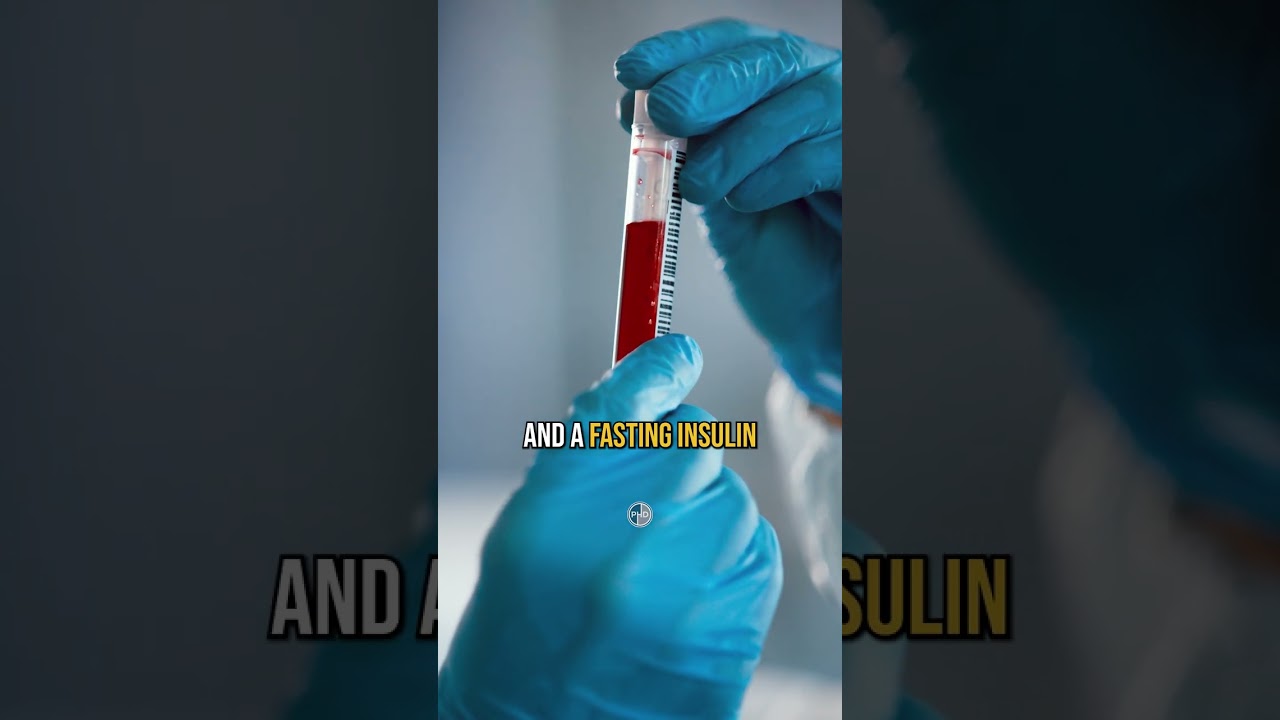 Don't Forget To Check THESE Next To a LIPID PANEL 👉