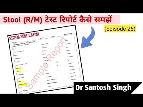 How To Read Stool R/M Test Report? Routine and Microscopy| Dr Santosh Singh (Episode 26)