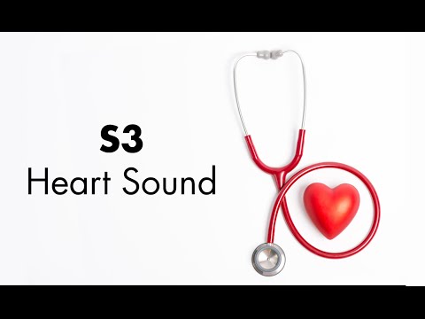 S3 Heart Sound - MEDZCOOL