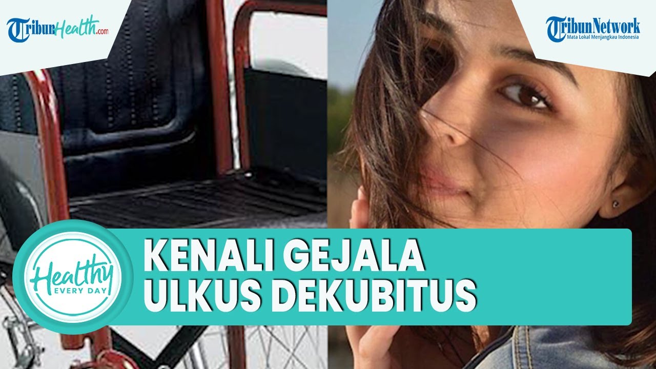 Kenali Penyebab dan Gejala Ulkus Dekubitus, Cedera Kulit Memicu ...